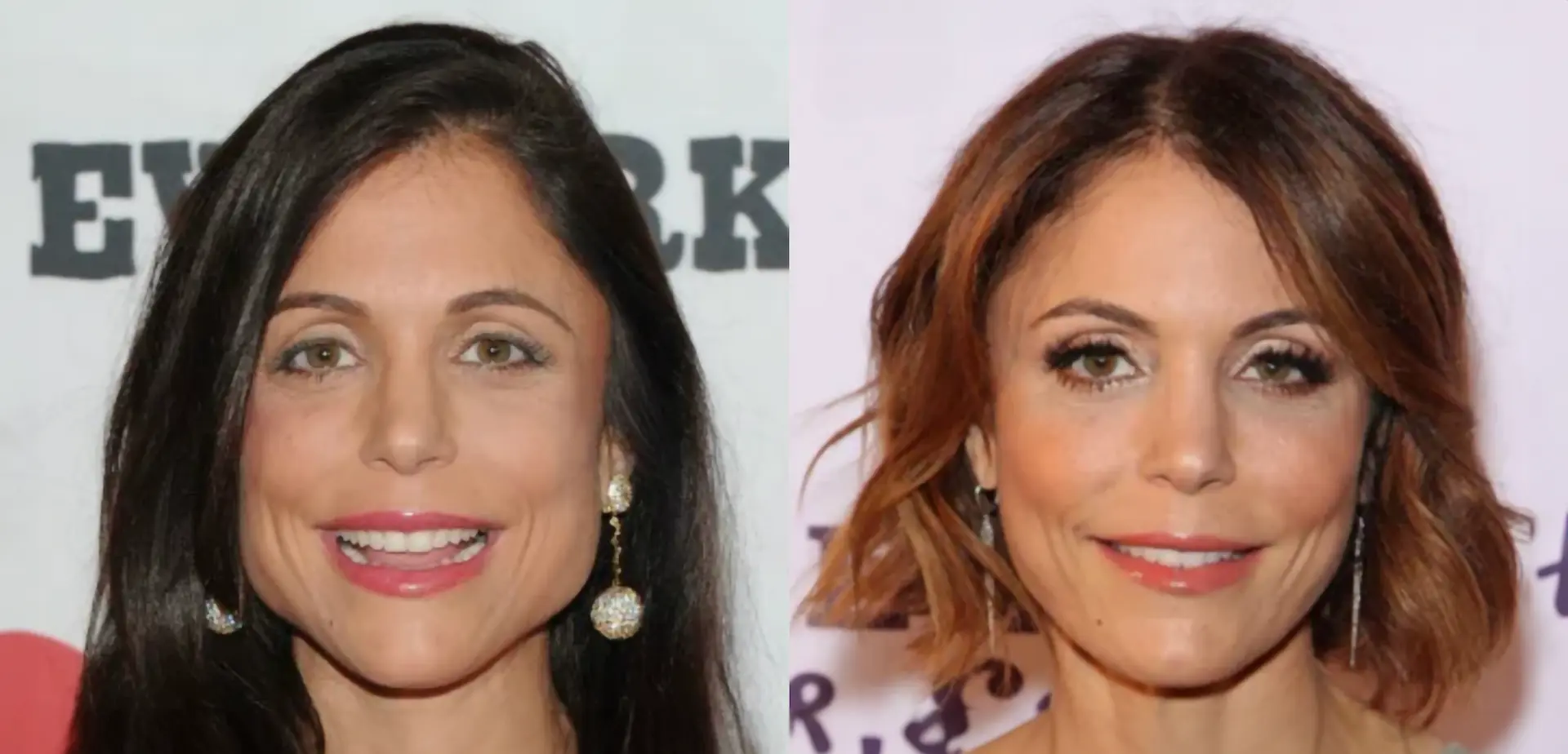 Masseter Botox: The Ultimate Guide to Jawline Slimming and Pain Relief ...