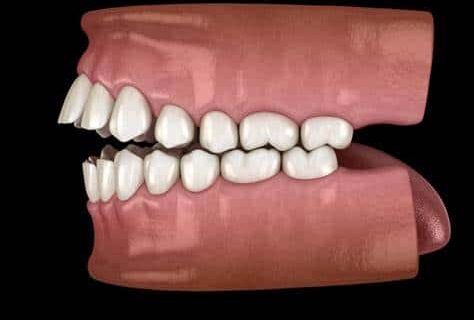 Understanding Knuckle Injuries: Signs, Symptoms, and Treatment of a ...